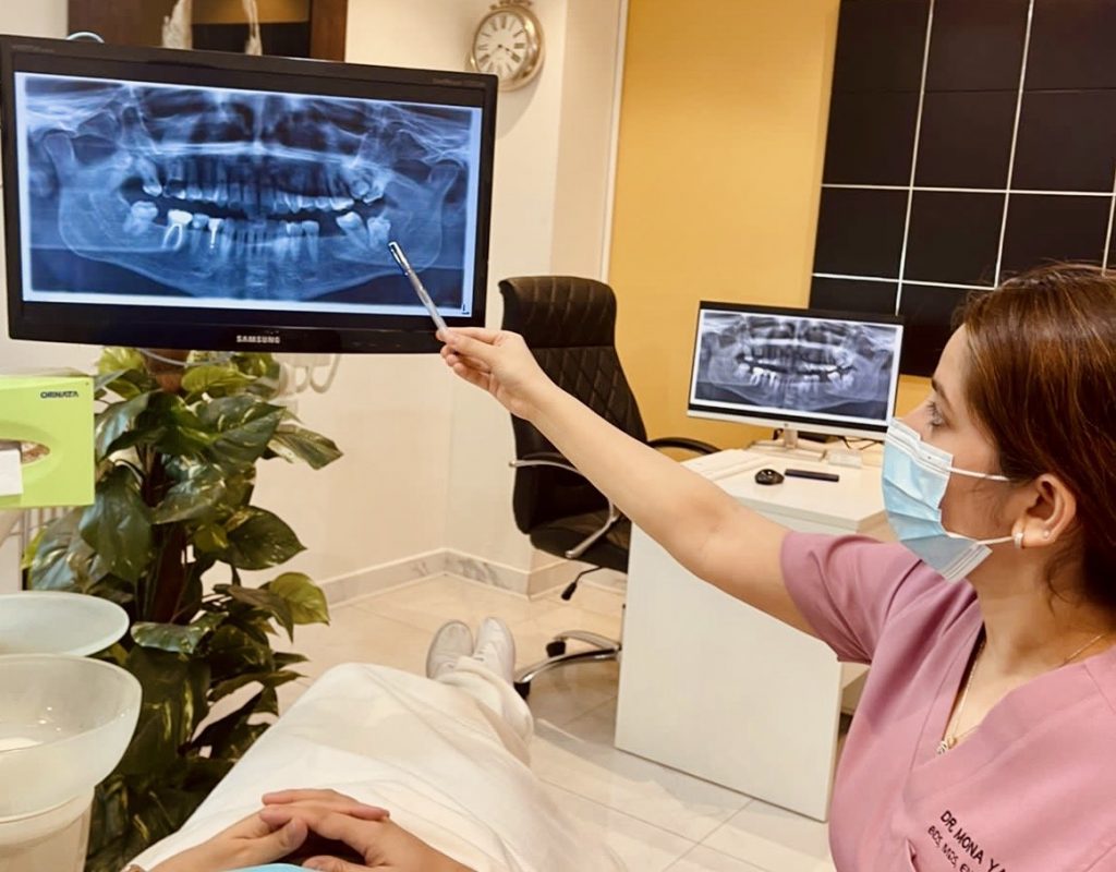Root Canal Treatment in Dubai | Root Canal Treatment Cost in Dubai